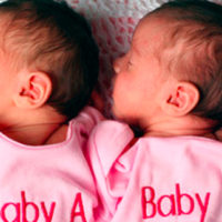Top 10 Bizarre And Rare Types Of Twins - Listverse