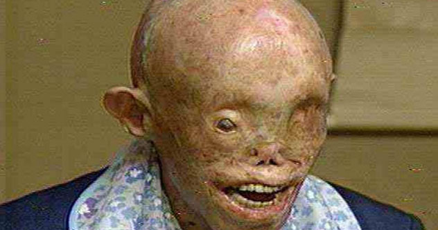 Forgotten Horrors: Ant-Walking Alligators of Hiroshima - Listverse