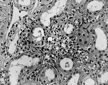 10 Weird Genetic Facts - Listverse