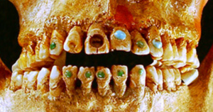10 Weird Facts About Teeth - Listverse