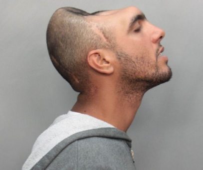 10 Freak Accidents People Somehow Survived - Listverse