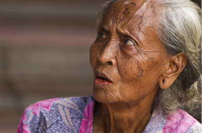 10 Mysterious Disorders That Only Hit Certain Cultures - Listverse