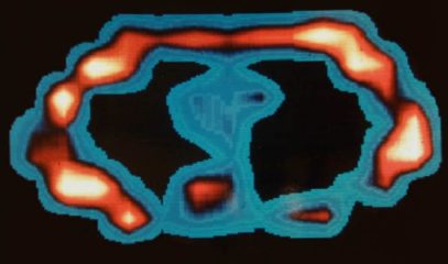 10 Images That Rocked The Medical World - Listverse