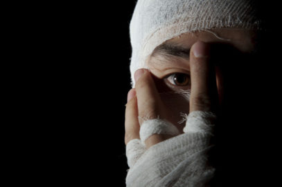 10 Awful Realities Behind The Lobotomy Craze - Listverse