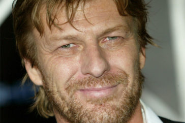 10 Wild Stories Of How Celebrities Got Their Scars - Listverse