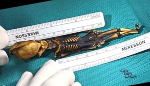 Top 10 Bizarre Skeletons - Listverse