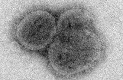 Top 10 Mysterious Viruses - Listverse