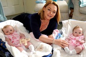 Top 10 Bizarre And Rare Types Of Twins - Listverse