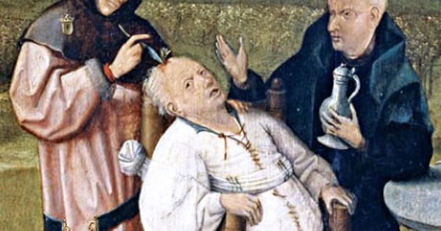 Top 10 Medical Treatments Worse Than Their Horrifying Diseases - Listverse