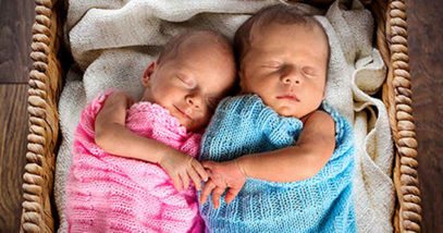 Top 10 Bizarre And Rare Types Of Twins - Listverse