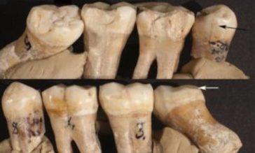 10 Secrets Locked In Ancient Teeth - Listverse