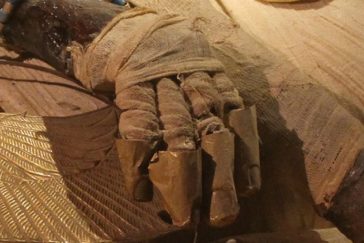 10 Human Body Parts Offered For Sale At Auction - Listverse