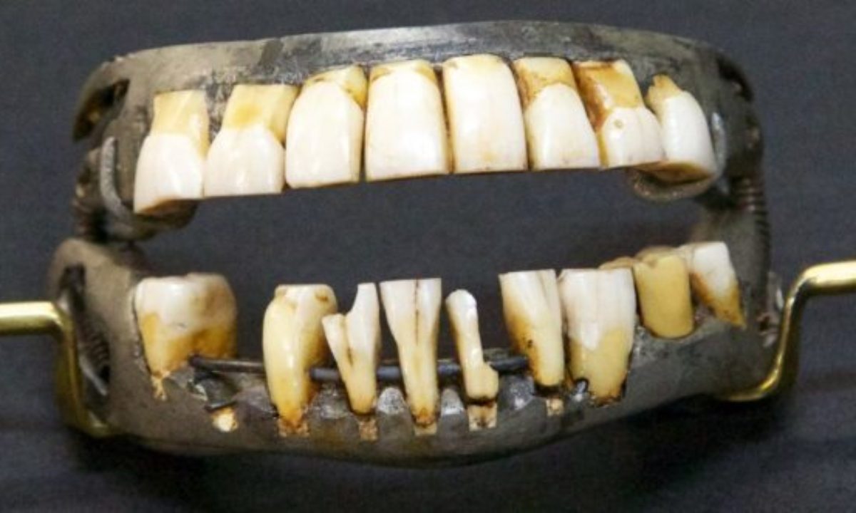 Ancient Egyptian Dentistry