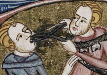 10 Horrors Of Dentistry Throughout History - Listverse