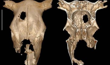 10 Unbelievable Things Doctors Could Do In The Stone Age - Listverse
