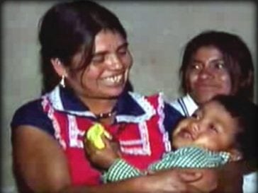 10 People Who Performed Surgeries On Themselves And Survived - Listverse