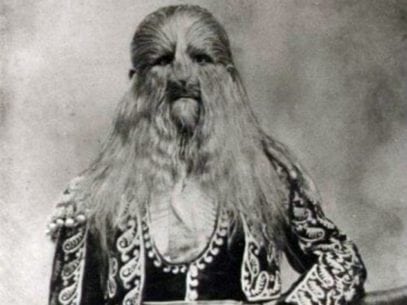 10 Heartbreaking Backstories Of Famous Sideshow Freaks - Listverse