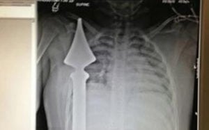 10 Gruesome Stories Of Impalement - Listverse