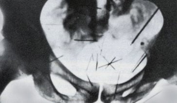 10 Chilling Facts About Serial Killer Albert Fish - Listverse