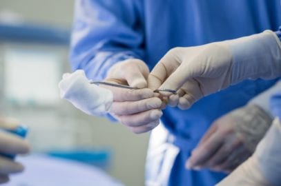 10 Troubling Items Left In Patients After Surgery - Listverse