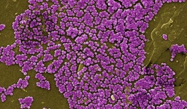 10 Nightmarish Flesh-Eating Pathogens That Consume Humans - Listverse