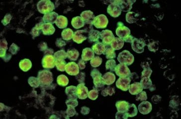 10 Nightmarish Flesh-Eating Pathogens That Consume Humans - Listverse