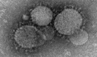 10 Deadly Viruses And Bacteria Created In Labs - Listverse