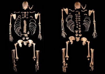 10 Times Bones Gave Rare Glimpses Into The Past - Listverse