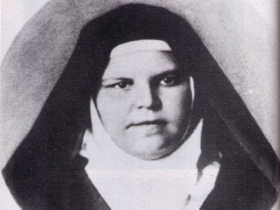 10 Truly Bizarre Cases of Stigmata - Listverse