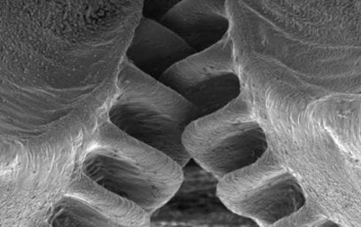 10 Strange Discoveries And Inventions Involving Insects - Listverse