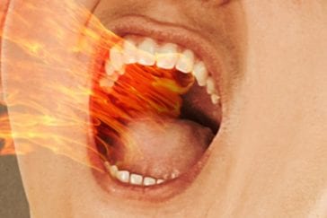 10 Bizarre Burnings Weirder Than Spontaneous Combustion - Listverse