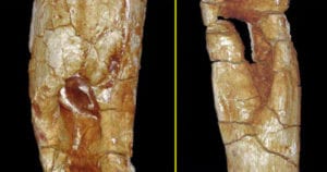 10 Diseases That Affected Dinosaurs - Listverse