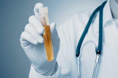 10 Unusual Urine Uses And Studies - Listverse