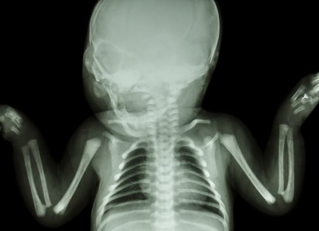 10 Awesome Scientific Facts About Newborns Listverse