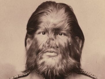 10 Amazing People With Hypertrichosis - Listverse
