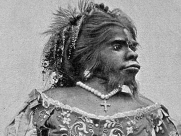 10 Amazing People With Hypertrichosis - Listverse