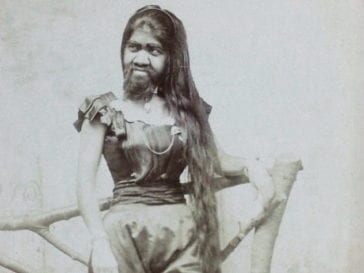 10 Amazing People With Hypertrichosis - Listverse