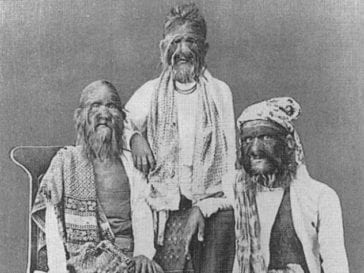 10 Amazing People With Hypertrichosis - Listverse