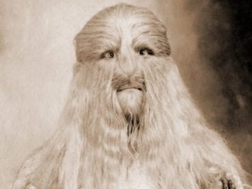 10 Amazing People With Hypertrichosis - Listverse