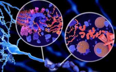 10 Frightening Facts About The Mysterious Deadly Prion Diseases - Listverse