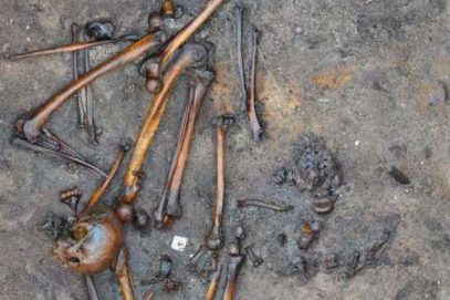 Top 10 Bizarre Bone Collections - Listverse